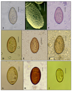 Practical guide for the diagnosis of helminth ova in stools – Annals of ...
