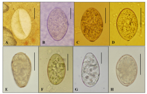 Practical guide for the diagnosis of helminth ova in stools – Annals of ...